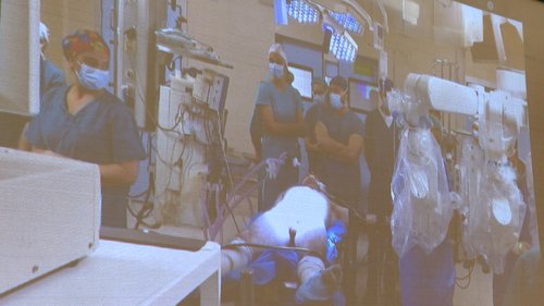 Historijski događaj: U KCUS-u izvedena prva robotski asistirana operacija