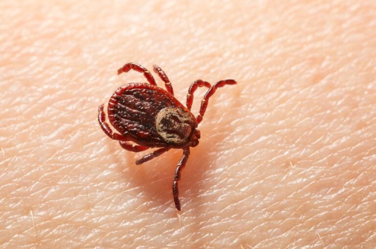Kako prepoznati infektivni ujed krpelja? - N1