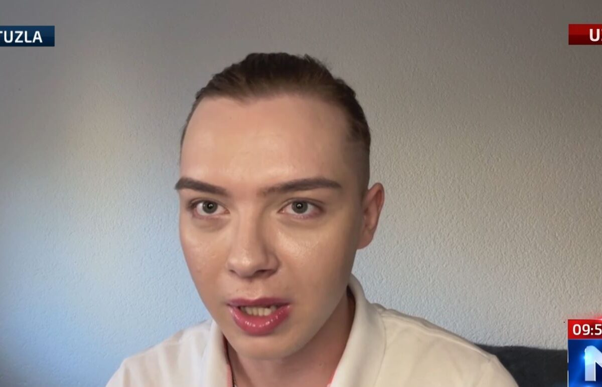 Mrkonjić: Kako pravilno voditi računa o koži tokom zime - N1